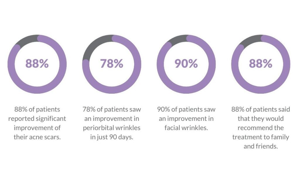 Exceed Microneedling Now at Aesthetica Medical Spa in Utah